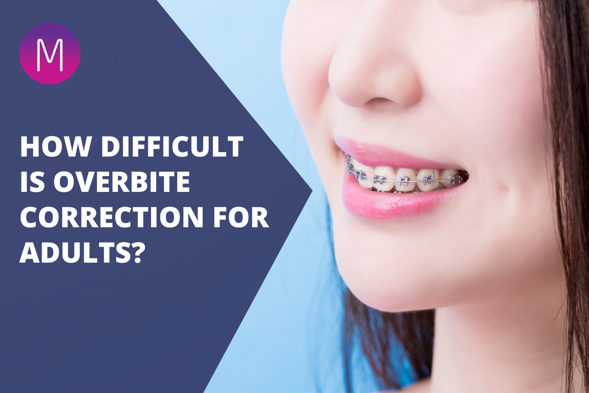 How Difficult Is Overbite Correction for Adults? | Medland Orthodontics