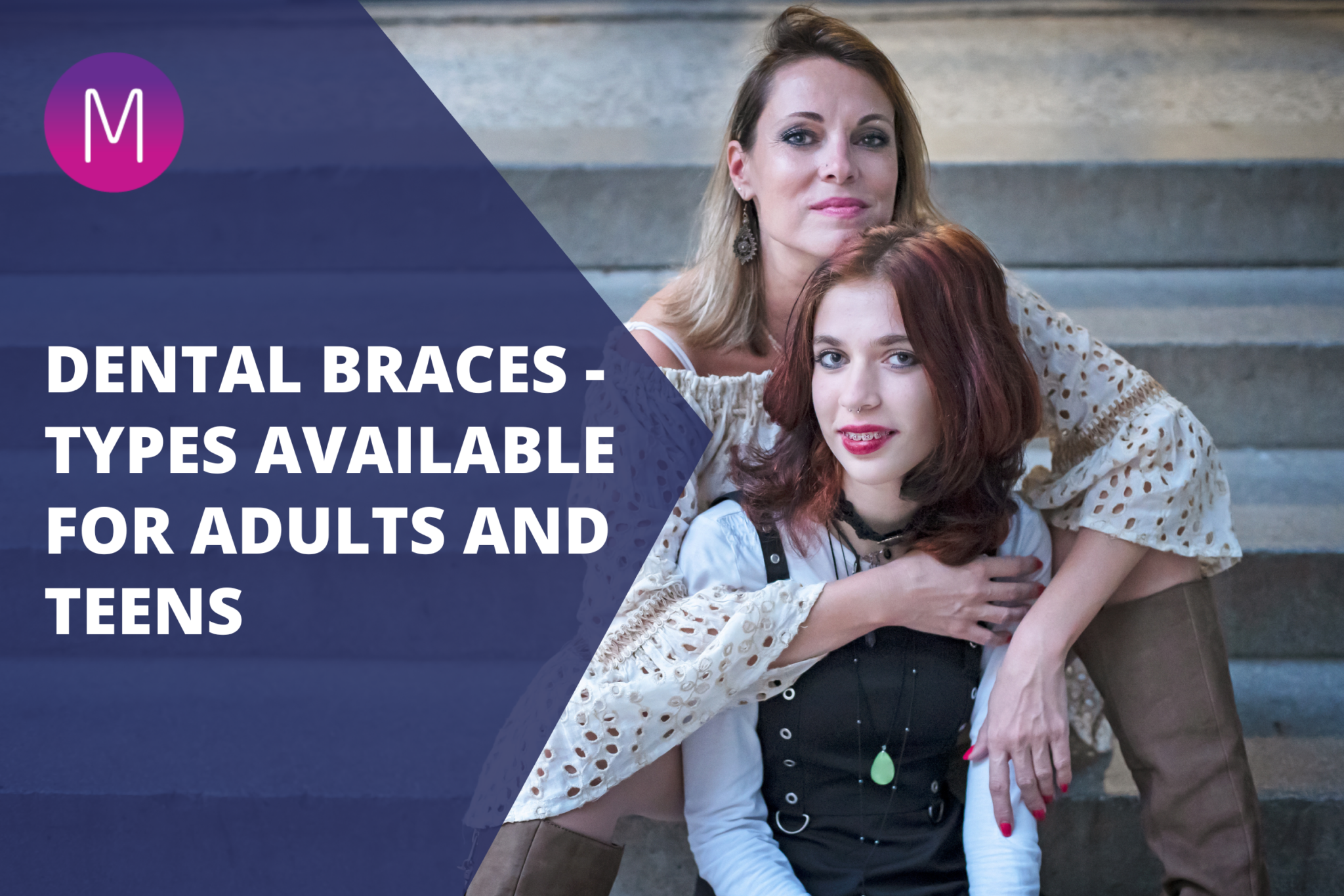 Dental Braces – Types Available for Adults and Teens