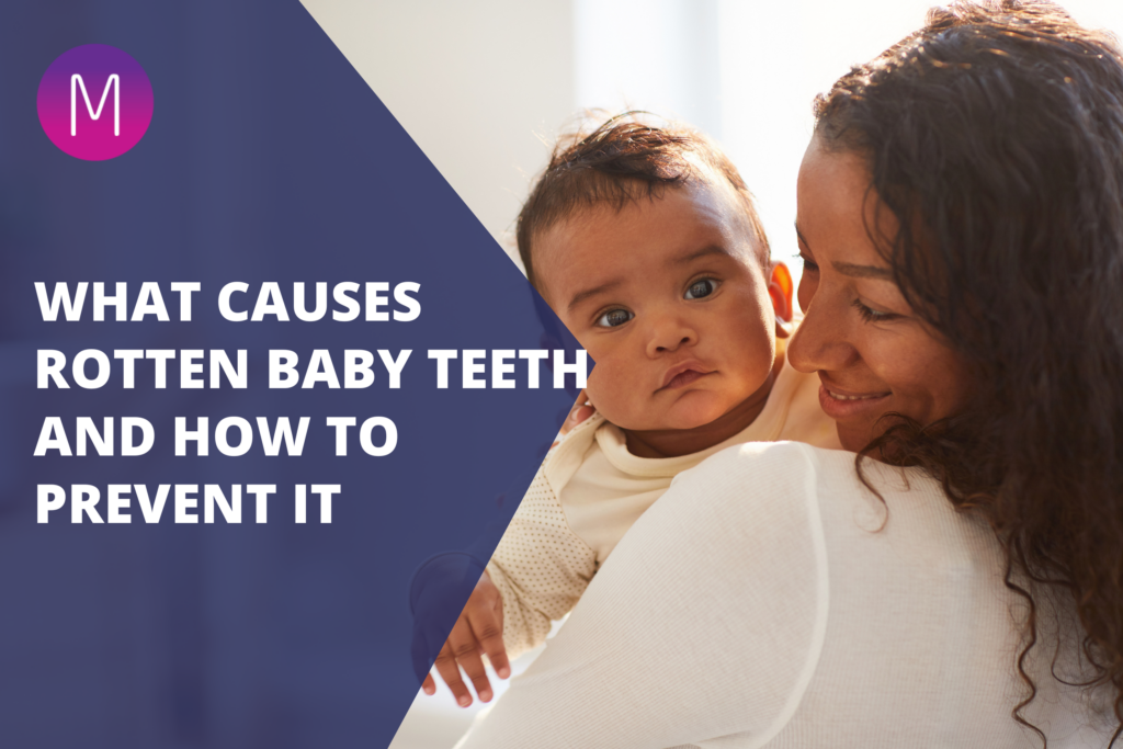 What Causes Rotten Baby Teeth and What Can You Do About It?