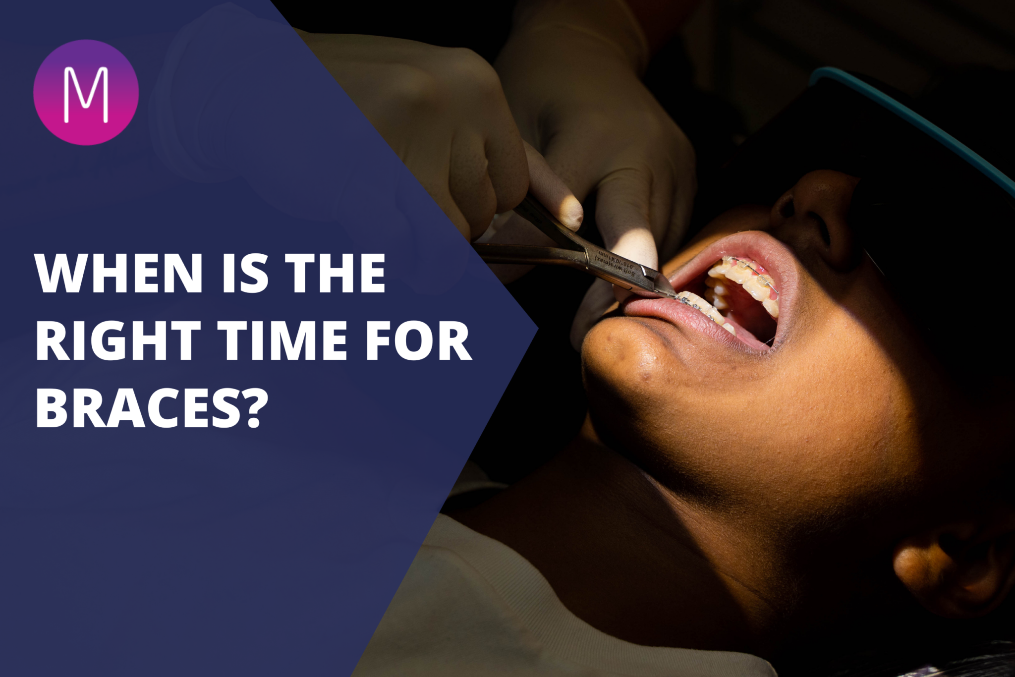 When Is the Right Time for Braces? | Medland Orthodontics