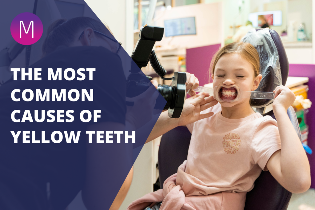 The Most Common Causes of Yellow Teeth in Children