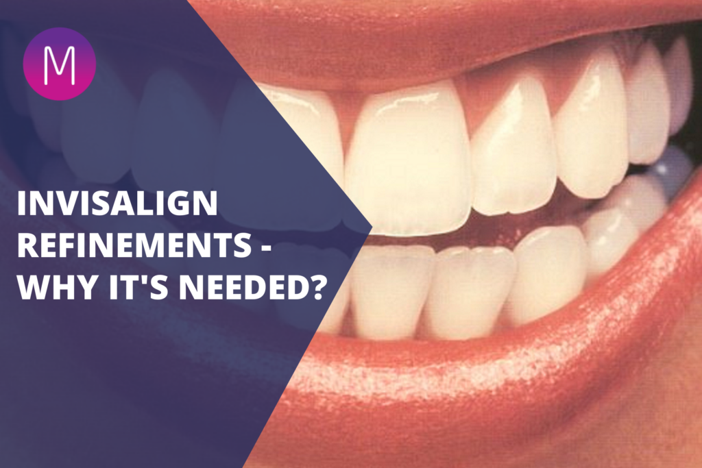 Invisalign Refinements - Why It's needed? - Medland Orthodontics